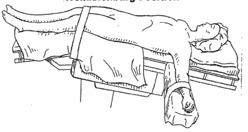 7 general Surgical Positions of Operating Table-News Releases-Heal ...